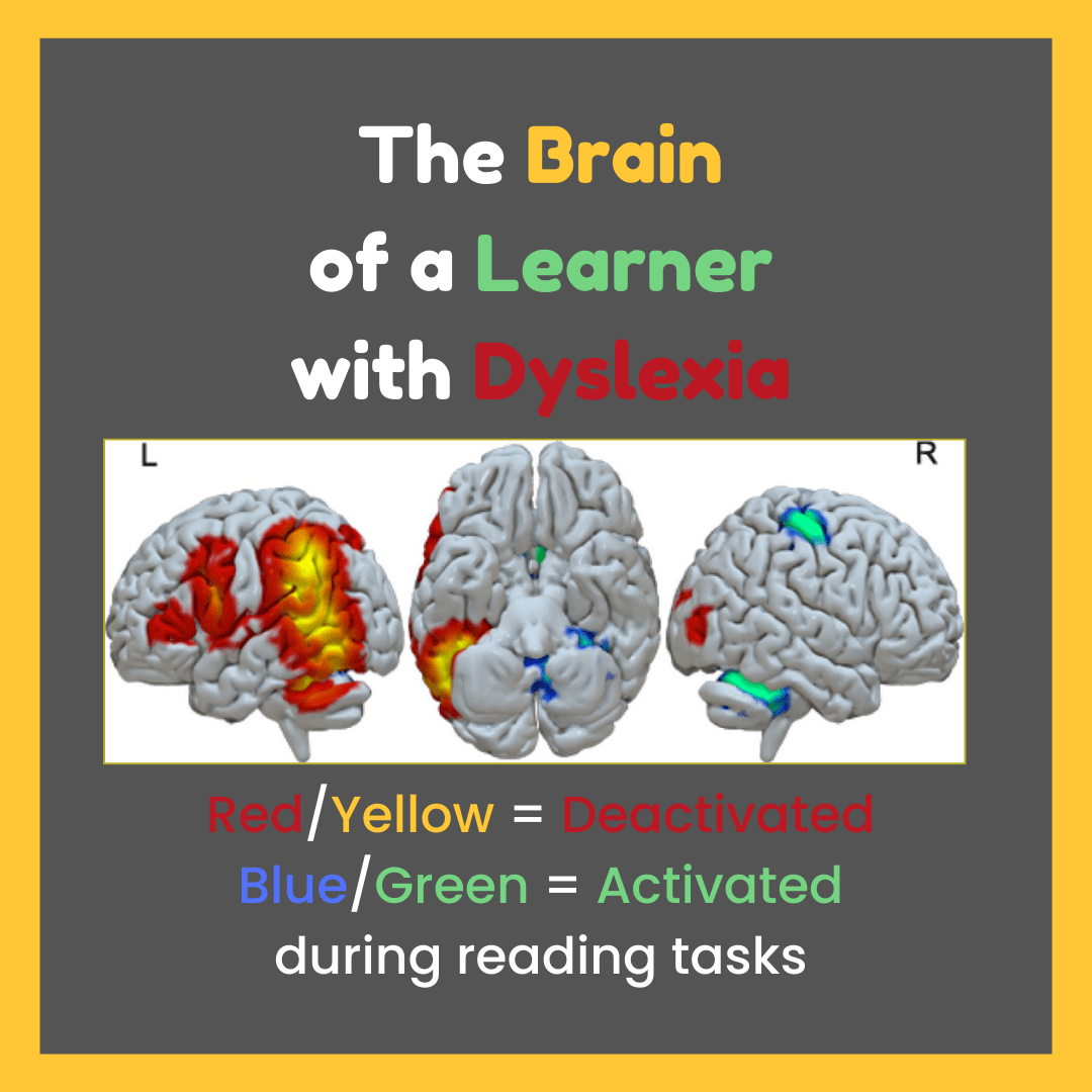 10 Helpful Tips for Homeschooling with Dyslexia More Effectively